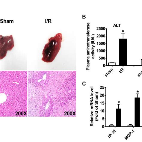 Characterics Of Liver Injury After Ischemiareperfusion Treatment A Characterics Of Liver Injury After Ischemiareperfusion Treatment A