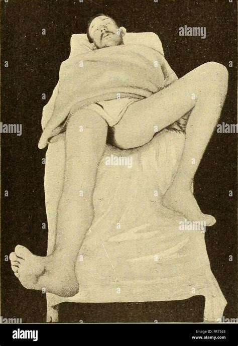 A Practical Treatise On Fractures And Dislocations 1899 Provides A Comprehensive Guide To The