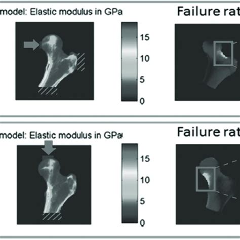 example of dexa based fe model application from left to right dexa