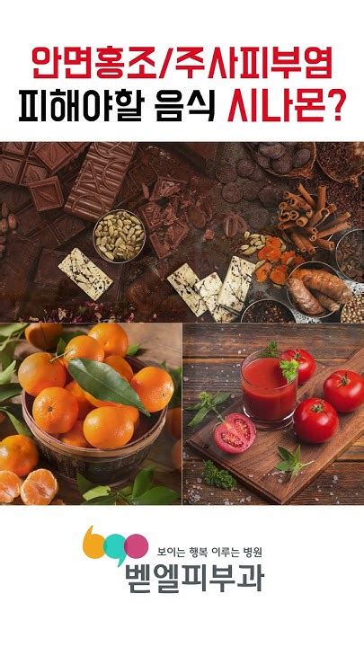 안면홍조 주사피부염 이것이 포함된 음식은 주의해야 합니다 Youtube