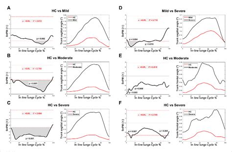 Figure 4 From Detection Of Kinematic Abnormalities In Persons With Knee Osteoarthritis Using