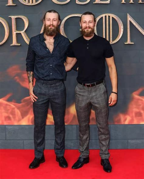 Shameless And Emmerdale Twins Luke And Elliot Tittensor Look