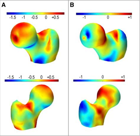 Evaluation Of Statistical Shape Modeling In Quantifying Femoral Morphologic Differences Between