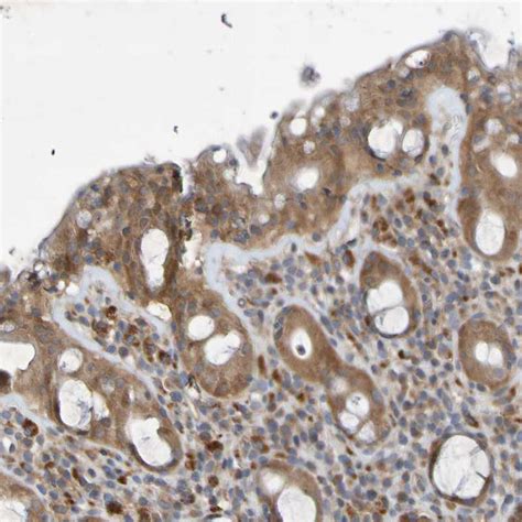 rabbit polyclonal anti sdk1 antibody buy for research highly