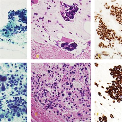 A Round Hypoechoic Well Defined Lymph Node With A 7 Mm Short Axis Download Scientific Diagram