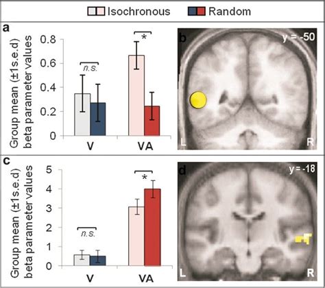 Auditory Tone Modulates Impact Of Visual Stimulus Timing On Psts Roi