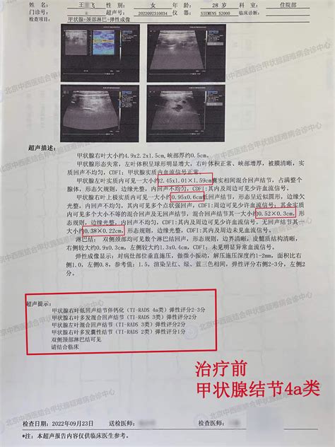 4a类甲状腺结节怎么调理消除？王克珍医生告诉你 搜狐大视野 搜狐新闻