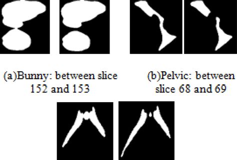 Figure 2 From The Performance Of 3d Multi Slice Branched Surface