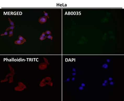 Beta Actin Ab Abways