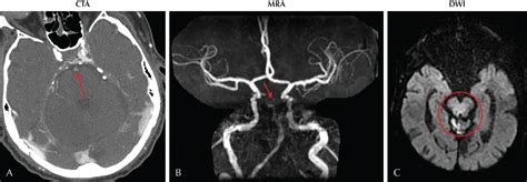 Coma Vegetative State And Brain Death Clinical Tree