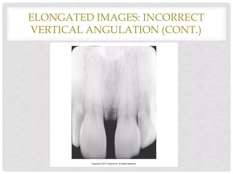 Chapter 20 Exposure And Technique Errors Ppt