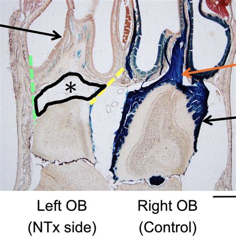 An Experimental Mouse Model Of Severe Olfactory Bulb Deafferentation Download Scientific