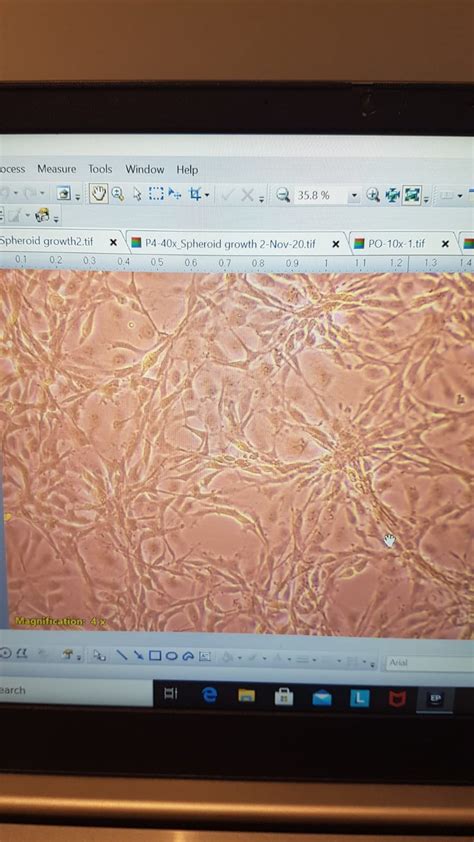 125 Questions With Answers In Seeding Density Science Topic