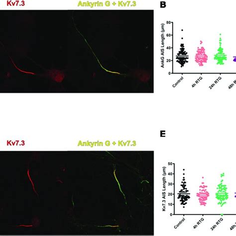 Chronic Retigabine Rtg Treatment Of Excitatory Neurons Triggered A Download Scientific