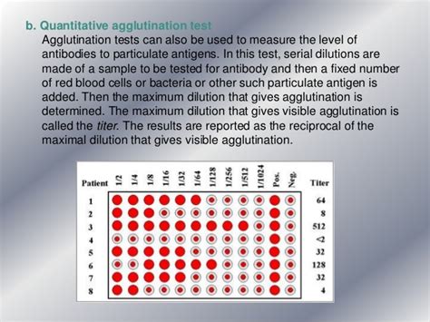 Importance Of Serial Dilution In Serology Kenqlero
