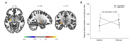 New Paper Effects Of Transcranial Direct Current Stimulation On Addictive Behavior And Brain