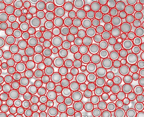 Size Characterization Of Microcapsules Adcis