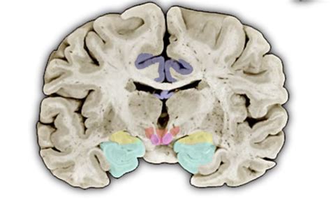 Coronal Section Diagram Quizlet
