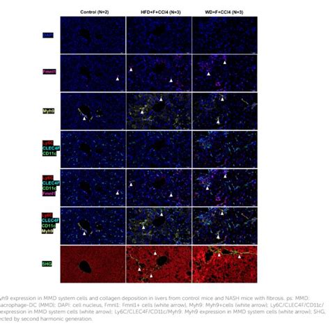 Scrna Seq Profiling Of Liver Cells From Normal And Nash Mice With Download Scientific Diagram