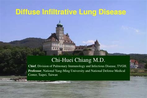 PPT Diffuse Infiltrative Lung Disease PowerPoint Presentation Free Download ID
