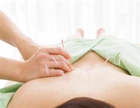 The Ultimate Guide To Dry Needling For Sciatica The Ultimate Guide To Dry Needling For Sciatica