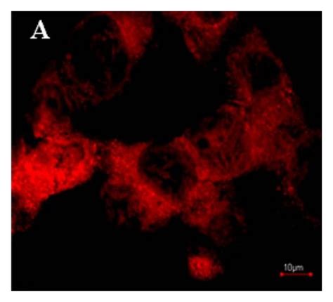 General Structure Of Polyhydroxyalkanoates Phas And Examples Of Their