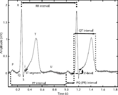 Figure 1 From Ecg Beat Classification Using Rr Interval Features And The Evidential K Nearest