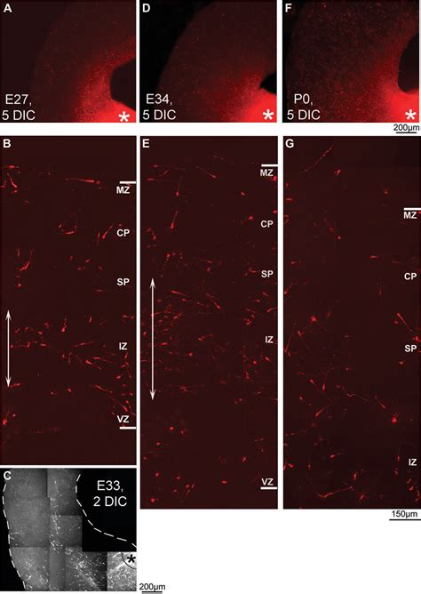 Figure 1 From Alteration Of Interneuron Migration In A Ferret Model Of Cortical Dysplasia