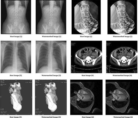 Dataset For Second Evaluation Contains Selected Grayscale DICOM Download Scientific Diagram
