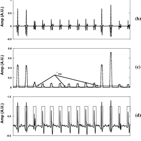 Stationary Wavelet Transform Download Scientific Diagram
