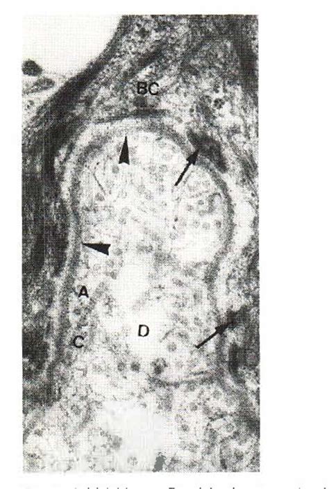 Figure 4 From The Ultrastructure Of The Dermo Epidermal Junction In