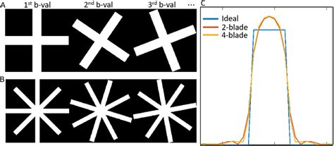 Figure 1 From Rapid Golden Angle Diffusion Weighted Propeller Mri For