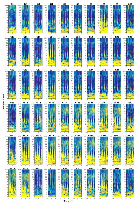 Morlet Wavelet Spectrogram Plot — Ieeg Pipelines 0 1 Documentation