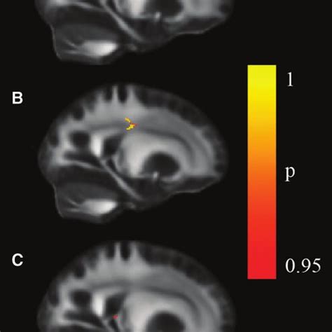 Neuropsychological Memory Tests Download Table