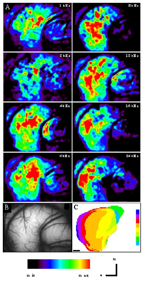 Isofrequency Domains In Cat Auditory Cortex As Revealed By Optical Download Scientific Diagram