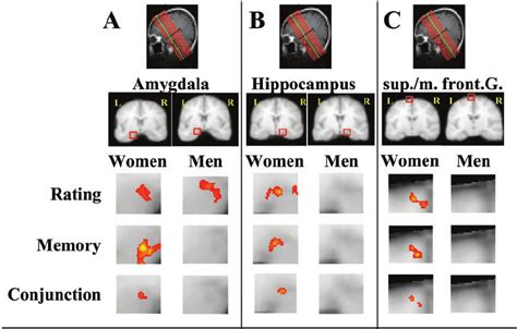 Colocalization Of Brain Regions Associated With Emotional Intensity