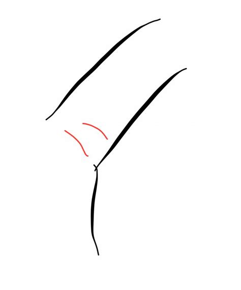 [잡담] 겨드랑이 착색 튼살 어떻게 하는 게 좋을까 인스티즈 Instiz 일상 카테고리