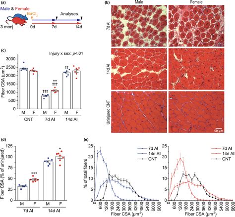 Sex Differences In Skeletal Muscle Size Function And Myosin Heavy