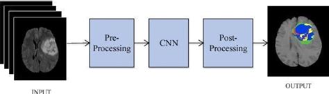Figure 1 From Brain Tumor Classification Using Convolutional Neural Network With Neutrosophy