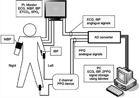 Schematic Graph Of Collecting Data The Two Photoplethysmogram Ppg Download Scientific