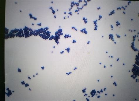 Solved Alcaligenes Viscolactis Bacillus