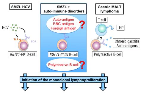 Marginal Zone Lymphoma Diagram
