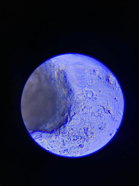 Is This A Clue Cell Rmicrobiology