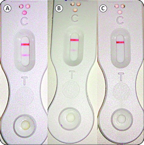 What Is Poc Urine Test At Lori Chambers Blog