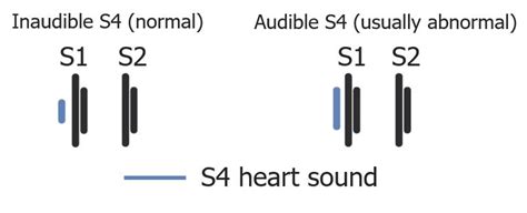 sonidos cardíacos concise medical knowledge