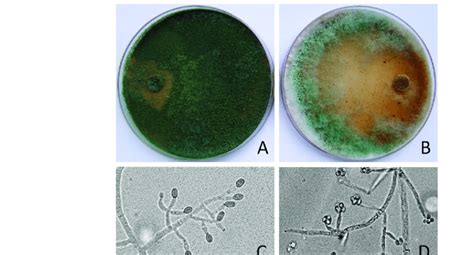 Macromorphology And Micromorphology Of Trichoderma Strains On Mea After