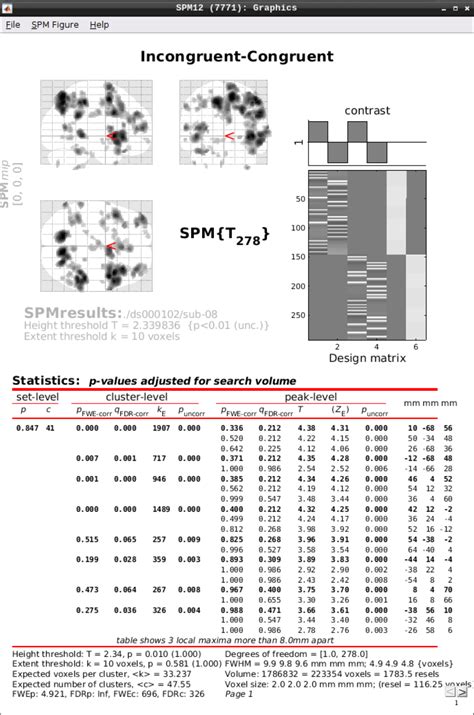 Statistical Parametric Mapping SPM Neurodesk