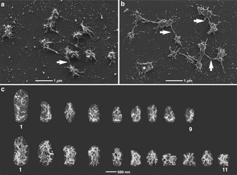Scanning Electron Micrographs Of Metaphase Chromosomes Of Giardia