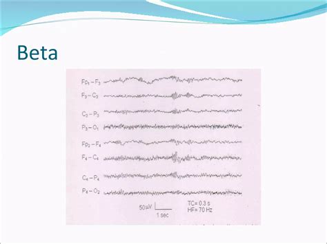 EEG Basics PPT