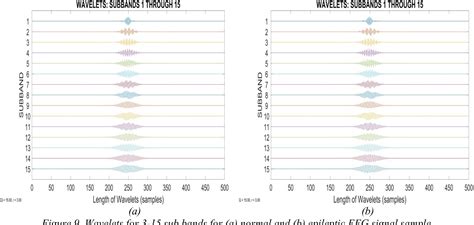 Figure 9 From A Review On Seizure Detection Systems With Emphasis On Multi Domain Feature
